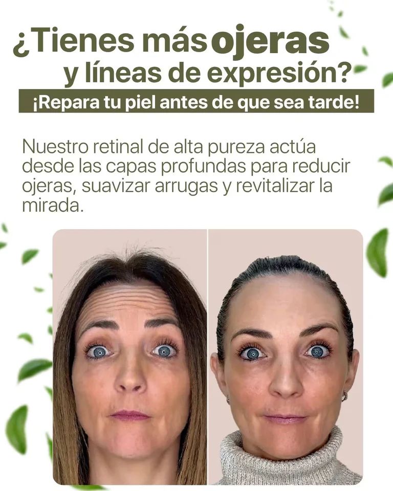 RETINAL SHOT- RETINOL – Innova store