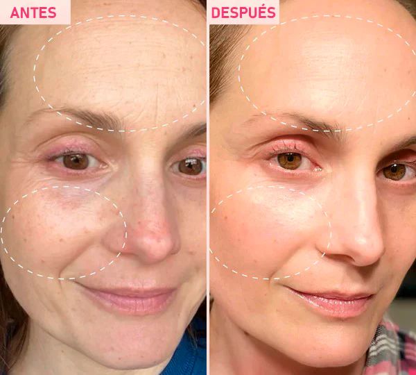 RETINAL SHOT- RETINOL – Innova store